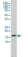 SSR4 Antibody (monoclonal) (M01) - Mouse monoclonal antibody raised ...