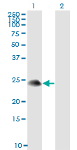 TSC22D3 Antibody (monoclonal) (M01) - Mouse monoclonal antibody raised ...