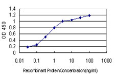 TSC22D3 Antibody (monoclonal) (M01) - Mouse monoclonal antibody raised ...