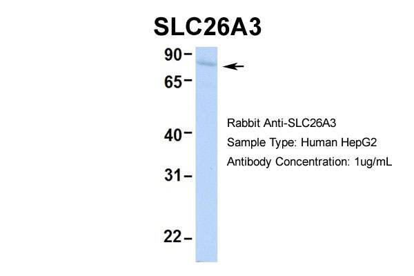 SLC26A3 antibody - middle region - Rabbit Polyclonal Antibody WB - Buy ...