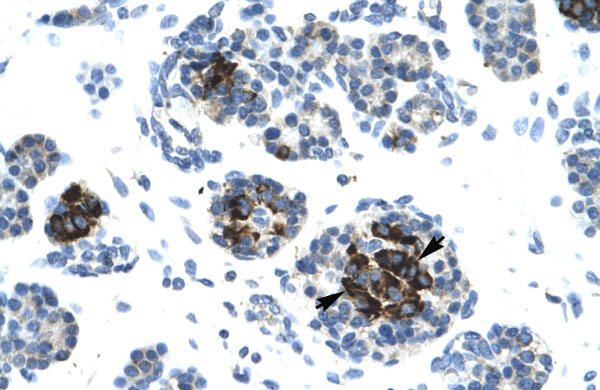 LIG4 antibody - N-terminal region - Rabbit Polyclonal Antibody WB, IHC ...