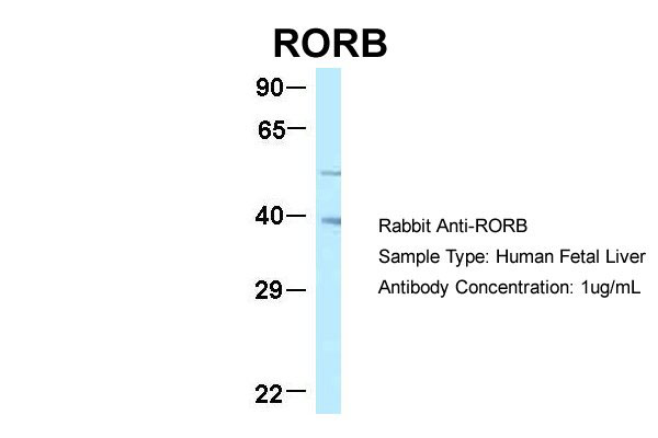 RORB antibody - C-terminal region - Rabbit Polyclonal Antibody WB - Buy ...