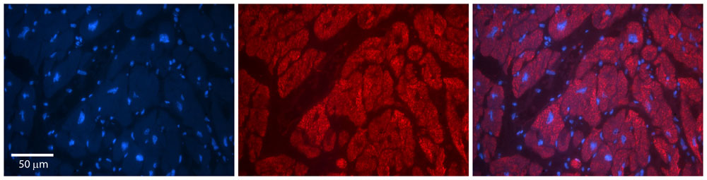 SLC6A5 Antibody - N-terminal region - Rabbit Polyclonal Antibody WB ...
