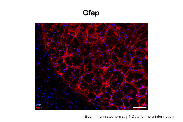 Gfap antibody - N-terminal region - Rabbit Polyclonal Antibody WB, IHC ...