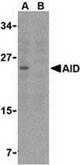 AICDA / AID Antibody (C-Terminus) - Rabbit Polyclonal Antibody WB, IHC ...