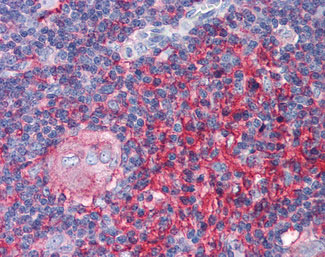 B2M / Beta 2 Microglobulin Antibody - Rabbit Polyclonal Antibody WB ...