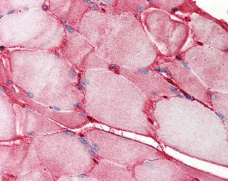 FN1 / Fibronectin Antibody - Rabbit Polyclonal Antibody WB, IHC-P, E ...