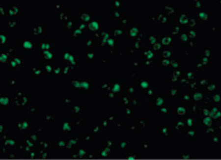 Hamartin / TSC1 Antibody - Rabbit Polyclonal Antibody WB, IHC-P, IF ...