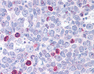 BAX Antibody (N-Terminus) - Rabbit Polyclonal Antibody WB, IHC-P, ICC ...