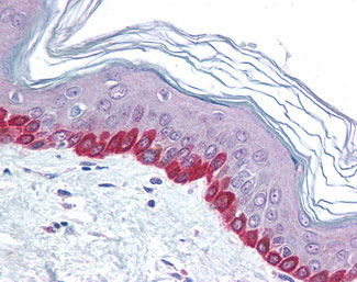STEAP2 Antibody (C-Terminus) - Rabbit Polyclonal Antibody WB, IHC-P ...