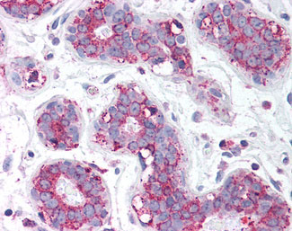 TBC1 / TBC1D1 Antibody (C-Terminus) - Rabbit Polyclonal Antibody WB ...