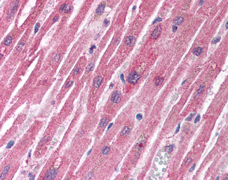 Hamartin / TSC1 Antibody (C-Terminus) - Rabbit Polyclonal Antibody WB ...