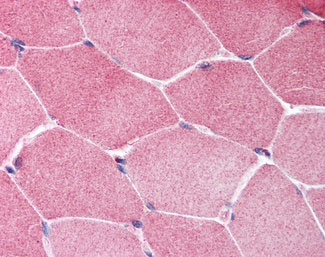 Hamartin / TSC1 Antibody (C-Terminus) - Rabbit Polyclonal Antibody WB ...