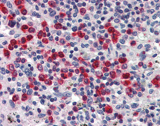LCN2 / Lipocalin 2 / NGAL Antibody (Internal) - Goat Polyclonal ...