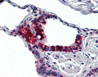 IVL / Involucrin Antibody (aa420-578) - Rabbit Polyclonal Antibody WB ...