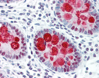 DFFA / ICAD / DFF45 Antibody (aa2-21) - Rabbit Polyclonal Antibody WB ...