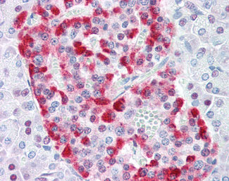 DFFA / ICAD / DFF45 Antibody (aa2-21) - Rabbit Polyclonal Antibody WB ...