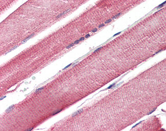 CPT1B Antibody (C-Terminus) - Goat Polyclonal Antibody IHC-P, E - Buy ...