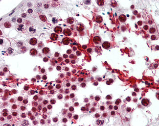 CCNE1 / Cyclin E1 Antibody (C-Terminus) - Rabbit Polyclonal Antibody ...