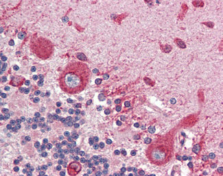 CALR / Calreticulin Antibody (clone 1G6A7) - Mouse Monoclonal Antibody ...