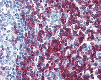 SPN / CD43 Antibody (clone 84-3C1) - Mouse Monoclonal Antibody WB, IHC ...