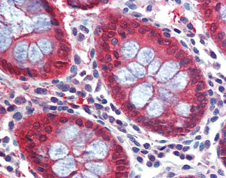 CASP7 / Caspase 7 Antibody (C-Terminus) - Rabbit Polyclonal Antibody WB ...