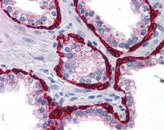 KRT15 / CK15 / Cytokeratin 15 Antibody (clone 6E7) - Mouse Monoclonal ...