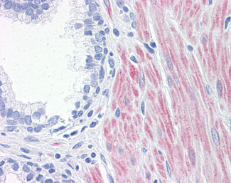 ALOX15 / 15-Lipoxygenase Antibody (clone 3D8) - Mouse Monoclonal ...