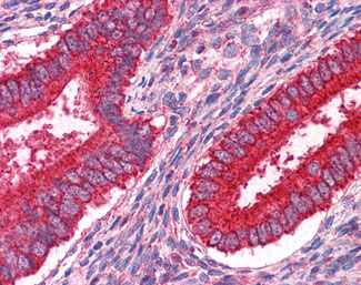 JUP/CTNNG/Junction Plakoglobin Antibody (clone 2G9) - Mouse Monoclonal ...