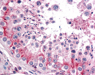 TLN1 / Talin Antibody (clone 2E10) - Mouse Monoclonal Antibody WB, IHC ...