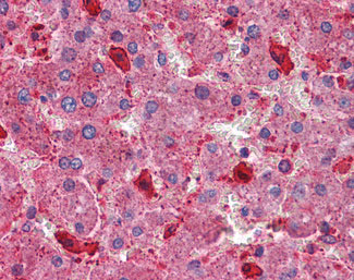 Hamartin / TSC1 Antibody (C-Terminus) - Goat Polyclonal Antibody WB ...