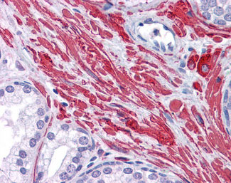 DES / Desmin Antibody (C-Terminus) - Goat Polyclonal Antibody WB, IHC-P ...