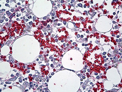 RBC / Red Blood Cells Antibody - Rabbit Polyclonal Antibody IHC-P - Buy ...