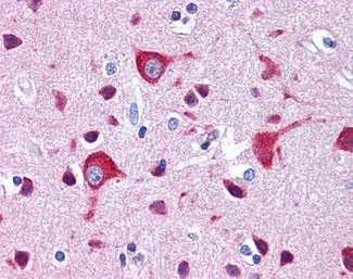 ZEB2 Antibody (C-Terminus) - Rabbit Polyclonal Antibody WB, IHC-P, IF ...