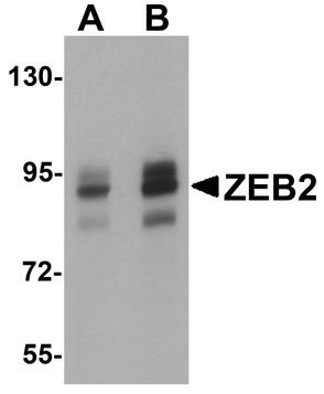 ZEB2 Antibody (C-Terminus) - Rabbit Polyclonal Antibody WB, IHC-P, IF ...