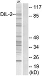 TPX2 Antibody (aa301-350) - Rabbit Polyclonal Antibody WB, IHC-P, E ...
