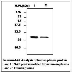 APCS / Serum Amyloid P / SAP Antibody (clone 6E6) - Mouse Monoclonal ...