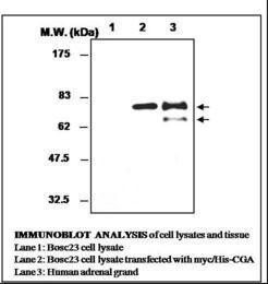 CHGA / Chromogranin A Antibody - Mouse Monoclonal Antibody WB, IHC-P ...