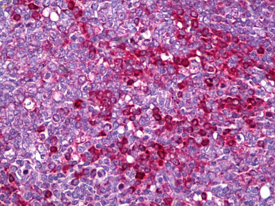 LGALS8 / Galectin 8 Antibody (aa61-110) - Rabbit Polyclonal Antibody WB ...