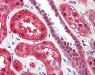 ALOX15 / 15-Lipoxygenase Antibody (Internal) - Goat Polyclonal Antibody ...