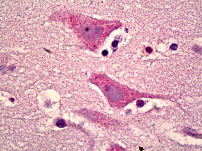 GPR151 Antibody (aa276-325) - Rabbit Polyclonal Antibody WB, IHC-P, IF ...