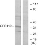 GPR119 Antibody (aa186-235) - Rabbit Polyclonal Antibody WB, IHC-P, IF ...