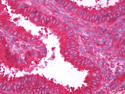 CTTN / Cortactin Antibody - Rabbit Polyclonal Antibody WB, IHC-P - Buy ...