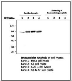 CTTN / Cortactin Antibody - Rabbit Polyclonal Antibody WB, IHC-P - Buy ...