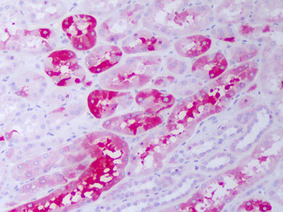 CRYAB / Alpha B Crystallin Antibody (clone 1A7.D5) - Mouse Monoclonal ...