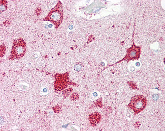 SYP / Synaptophysin Antibody (aa101-150) - Rabbit Polyclonal Antibody ...