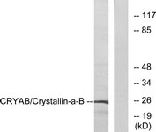 CRYAB / Alpha B Crystallin Antibody (aa10-59) - Rabbit Polyclonal ...
