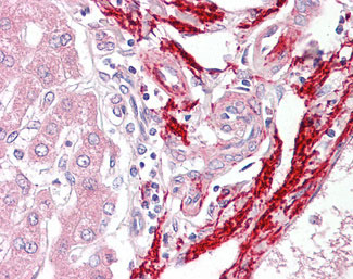 VTN / Vitronectin Antibody - Mouse Monoclonal Antibody WB, IHC-P, E ...