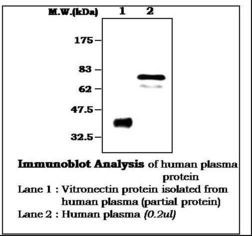 VTN / Vitronectin Antibody - Mouse Monoclonal Antibody WB, IHC-P, E ...