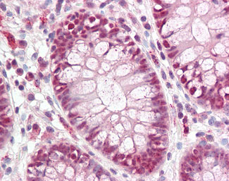 CDX2 Antibody (aa1-60) - Rabbit Polyclonal Antibody WB, IHC-P - Buy Now ...